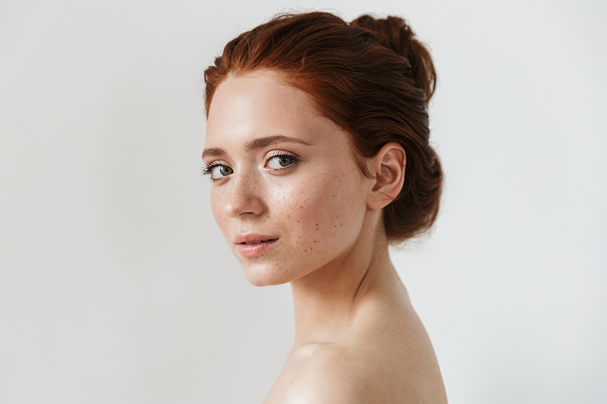 Forever Clear BBL Newport Beach | Achieve Acne-Free Skin